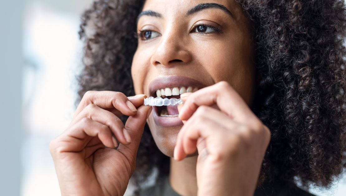 Understanding Invisalign: Benefits, Process, and Costs | Davis Dentistry